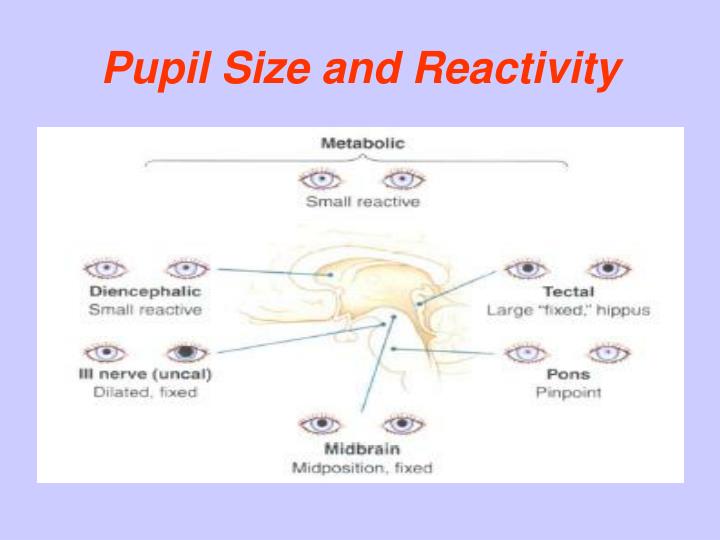 PPT - Decreased level of consciousness PowerPoint Presentation - ID:6660923