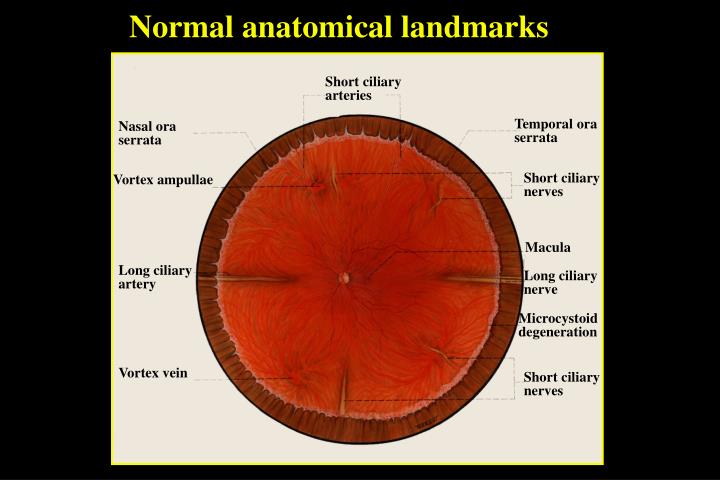 PPT - INTRODUCTION TO RETINAL DETACHMENT (RD) PowerPoint Presentation ...