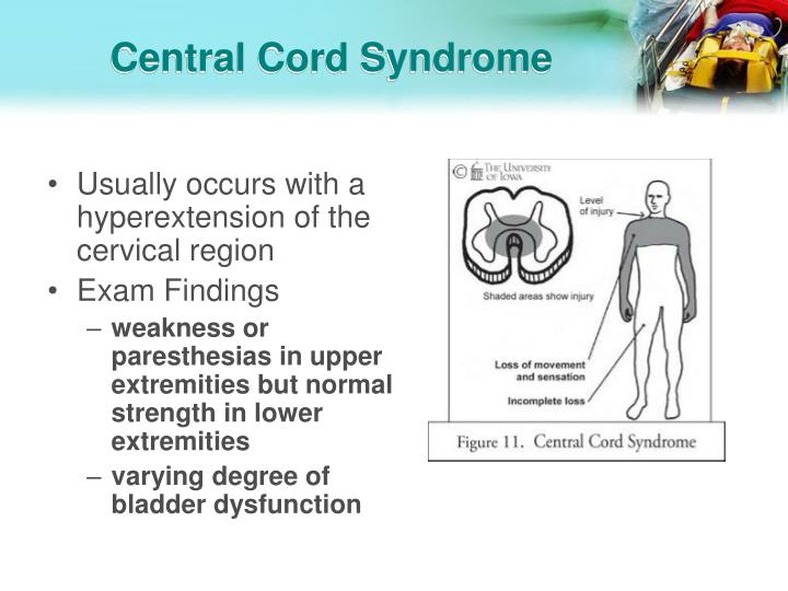 PPT - Spinal cord injury PowerPoint Presentation - ID:6662775