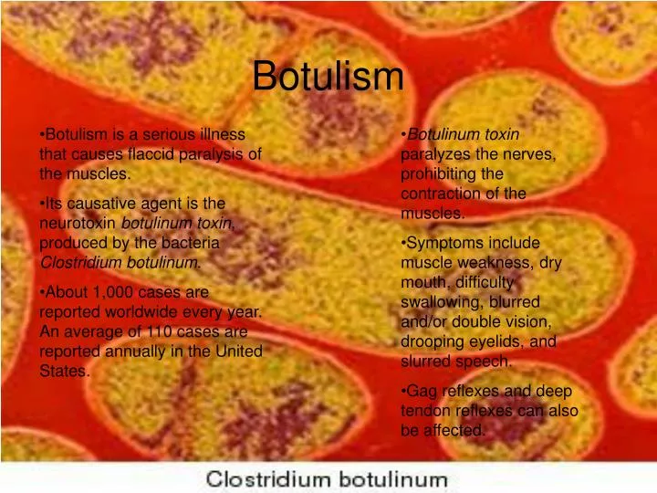 PPT - Botulism PowerPoint Presentation, free download - ID:6666626