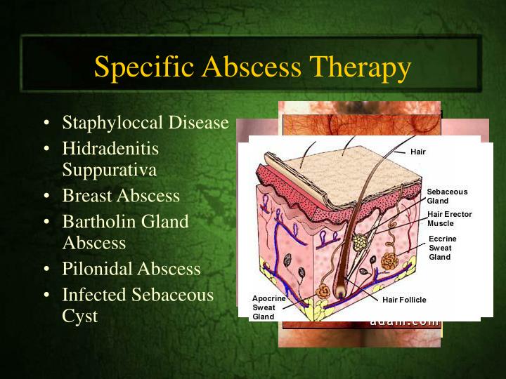 Groin Abscess Drainage