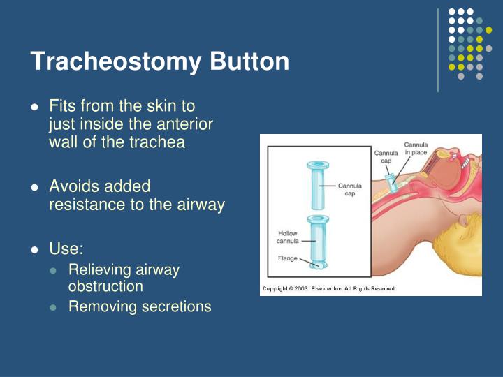 PPT - Airway Management Part III PowerPoint Presentation - ID:6667975