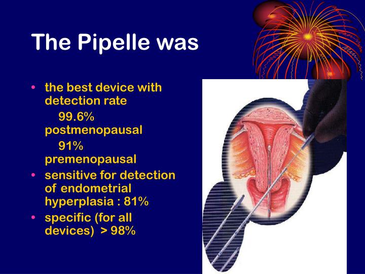 PPT - Diagnostic Techniques for Endometrial Cancer PowerPoint ...