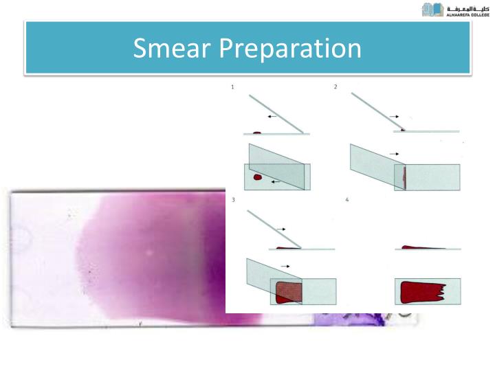 PPT - DIFFERENTIAL LEUCOCYTE COUNT (DLC) PowerPoint Presentation - ID ...