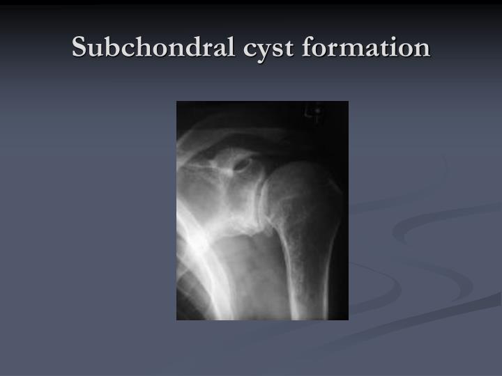 PPT - Osteoarthritis PowerPoint Presentation - ID:6675637