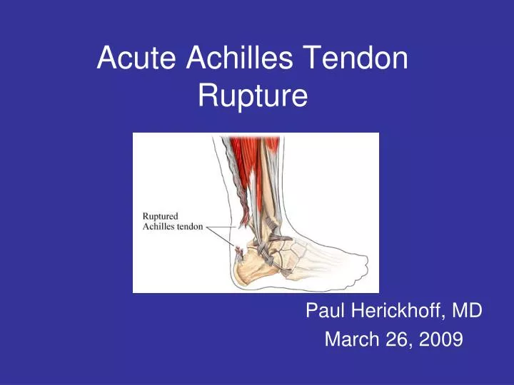 PPT - Acute Achilles Tendon Rupture PowerPoint Presentation, free download - ID:6677846