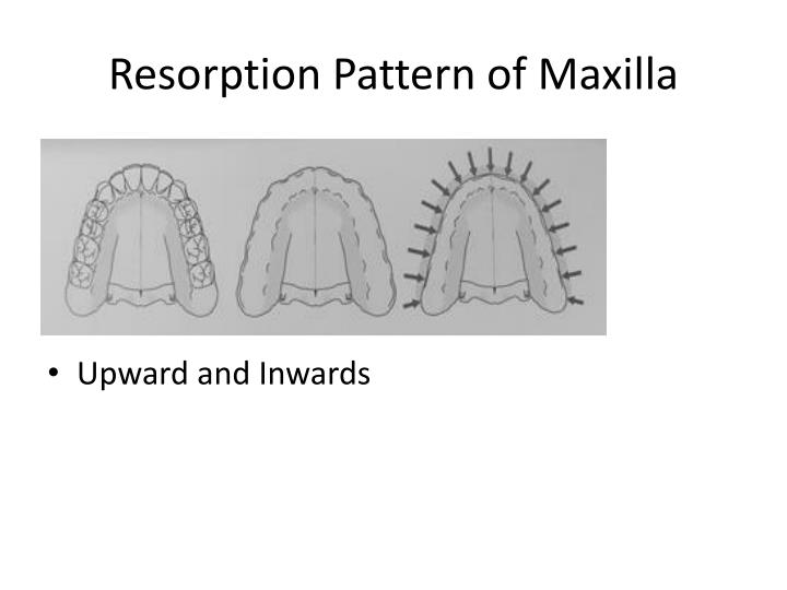 PPT - Preprosthetic Surgery PowerPoint Presentation - ID:6677993