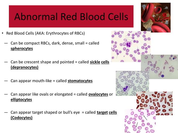 PPT - Abnormal Blood Cell Morphology PowerPoint Presentation - ID:6679046
