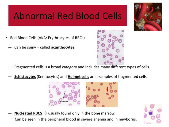 PPT - Abnormal Blood Cell Morphology PowerPoint Presentation - ID:6679046