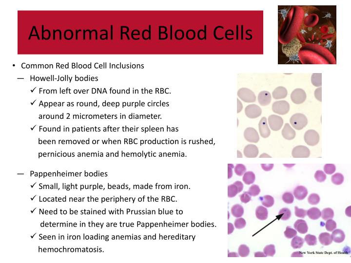 PPT - Abnormal Blood Cell Morphology PowerPoint Presentation - ID:6679046