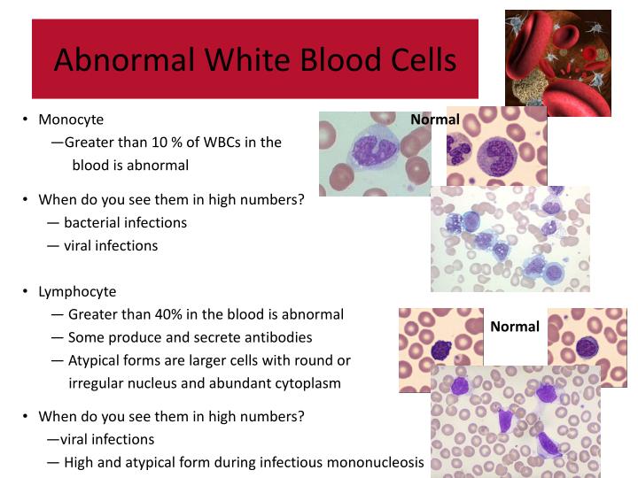 PPT - Abnormal Blood Cell Morphology PowerPoint Presentation - ID:6679046