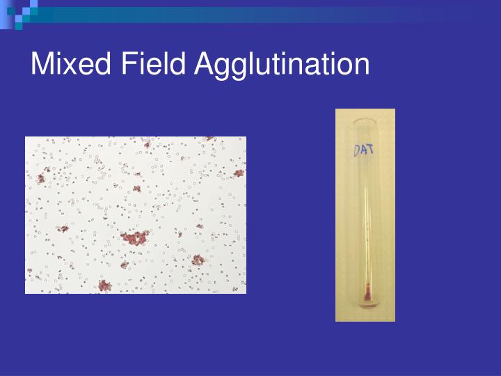 PPT - ABO and H Blood Groups PowerPoint Presentation - ID:6679262