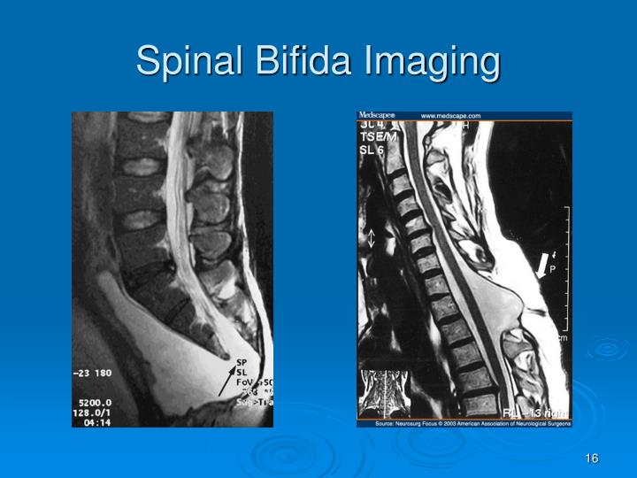 PPT - CNS Pathology PowerPoint Presentation - ID:6682190