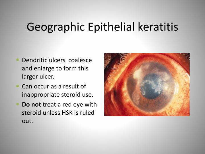 PPT - Interactive Ophthalmology Quiz PowerPoint Presentation - ID:6686714
