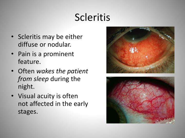 PPT - Interactive Ophthalmology Quiz PowerPoint Presentation - ID:6686714