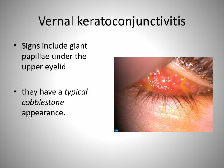 PPT - Interactive Ophthalmology Quiz PowerPoint Presentation - ID:6686714