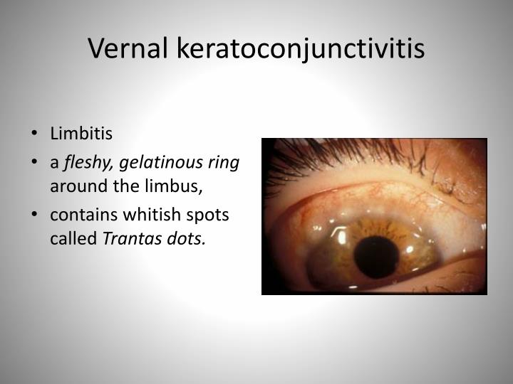 PPT - Interactive Ophthalmology Quiz PowerPoint Presentation - ID:6686714