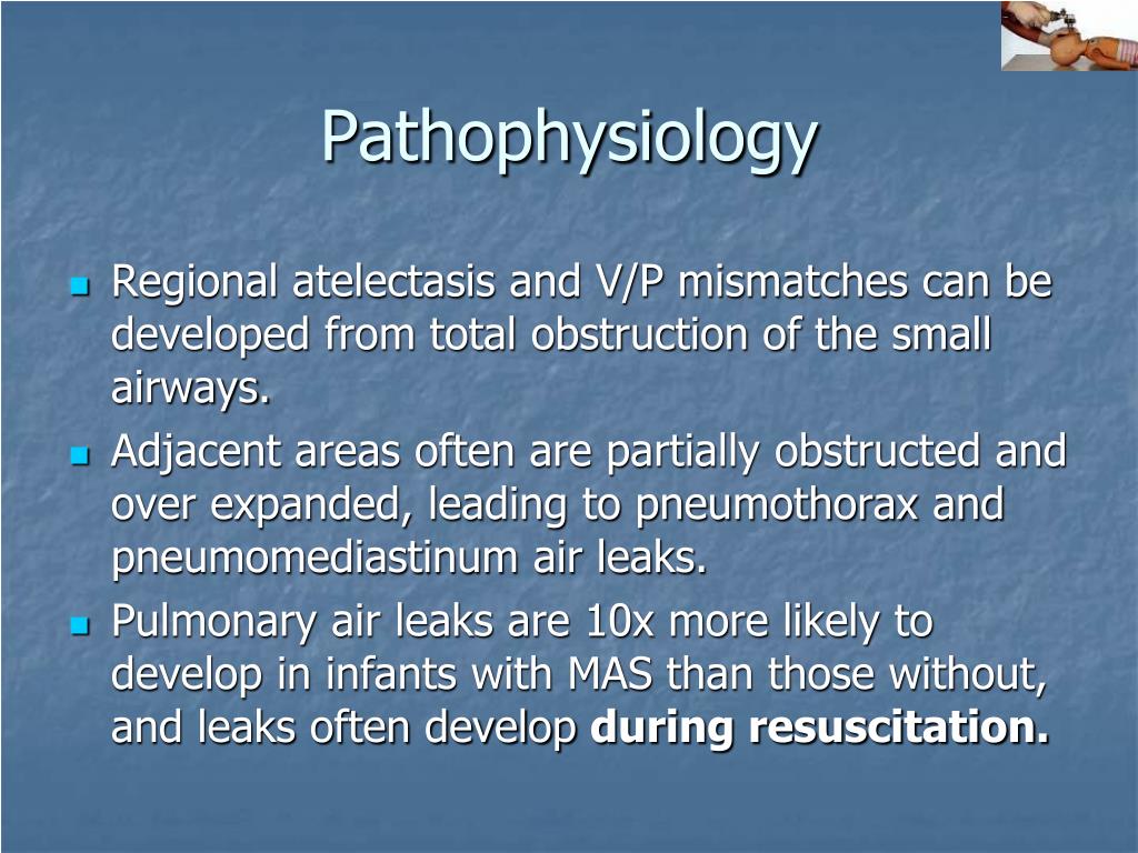 PPT - Meconium-stained amniotic fluid (MSAF) Pediatrics point of view ...