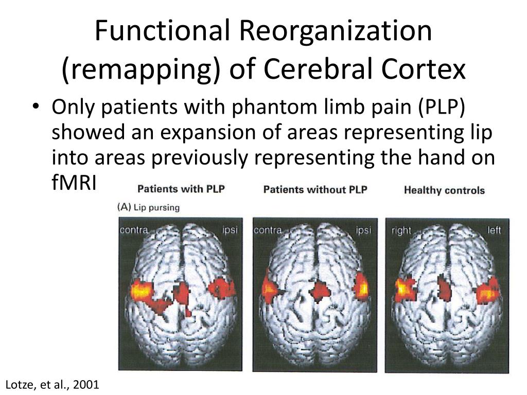 PPT - PTP 512 Neuroscience in Physical Therapy Neuroplasticity ...