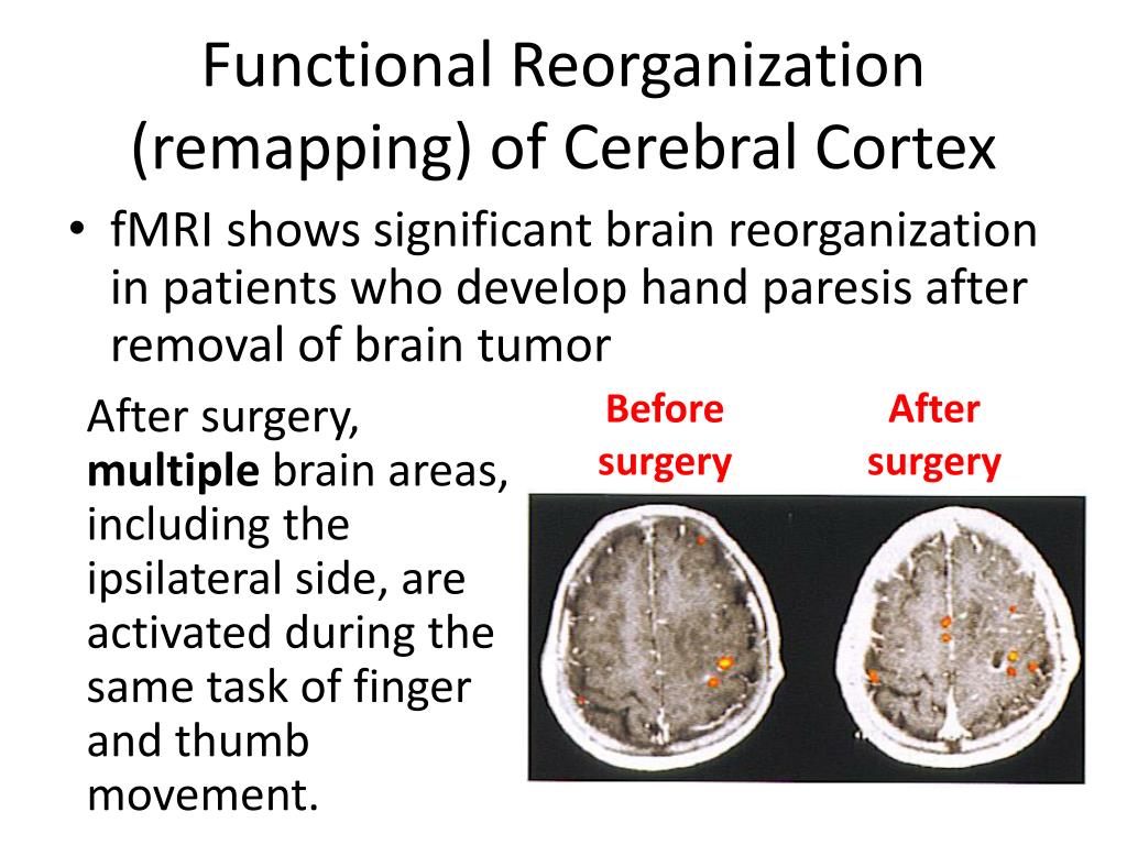 PPT - PTP 512 Neuroscience in Physical Therapy Neuroplasticity ...