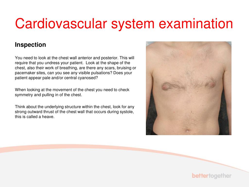 PPT - UWE Bristol Cardiovascular system examination PowerPoint ...