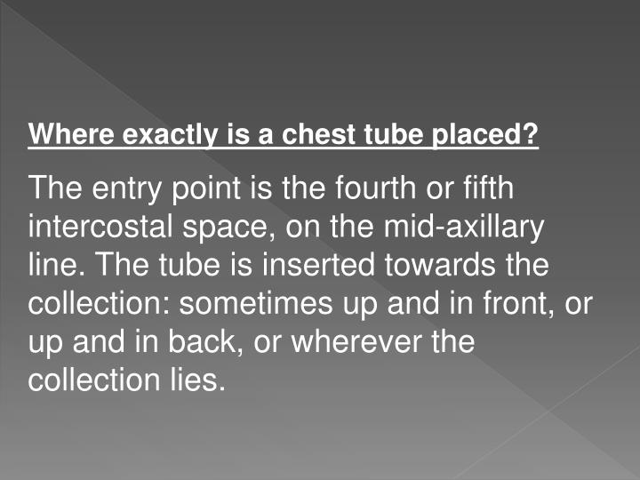 PPT - Chest Tubes PowerPoint Presentation - ID:6699212