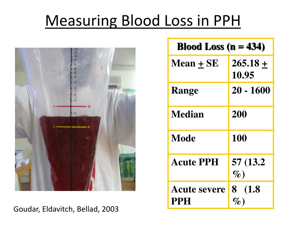PPT - UPDATE OF NEW TECHNOLOGIES TO TREAT POSTPARTUM HAEMORRHAGE ...