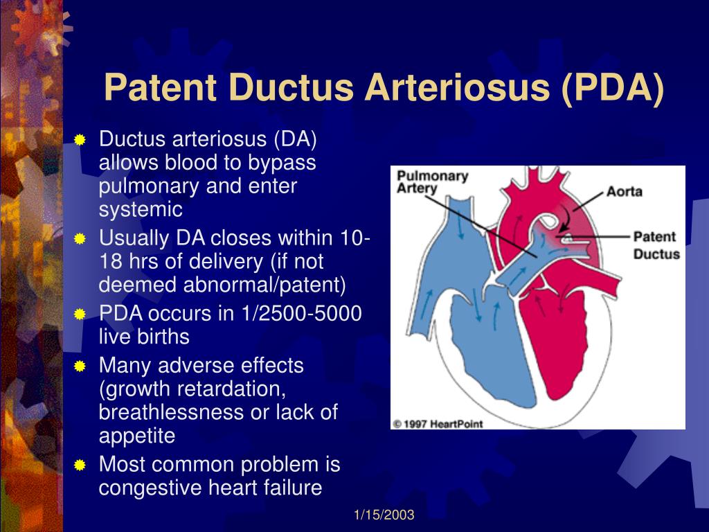 Ppt Patent Ductus Arteriosus Occlusion Device Oral Presentation 1