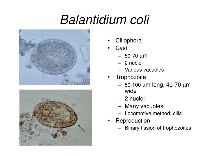 PPT - Protozoan parasites PowerPoint Presentation - ID:6702953