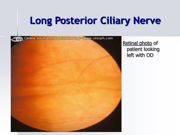 PPT - Review of Retinal Mapping PowerPoint Presentation - ID:6705943