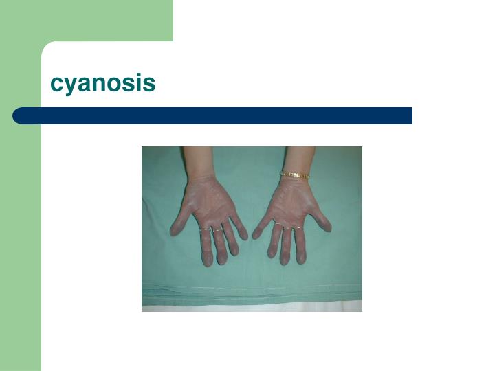 PPT - General Physical Examination PowerPoint Presentation - ID:6711564