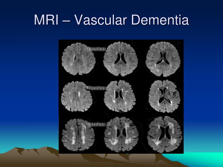 PPT - Dementia PowerPoint Presentation - ID:6714978