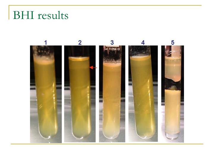 PPT - Bacterial Requirements PowerPoint Presentation - ID:6717133