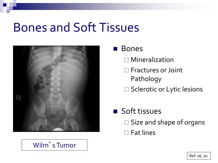 PPT - Reading Abdominal X-rays and Head CTs PowerPoint Presentation ...