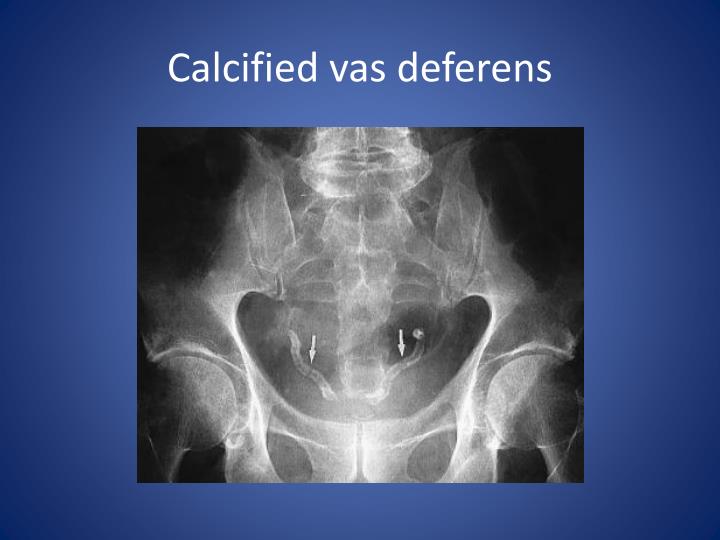 PPT - Abdominal X-ray Radiological Signs PowerPoint Presentation - ID ...