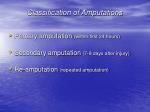 PPT - Indications to Amputations PowerPoint Presentation - ID:6719754