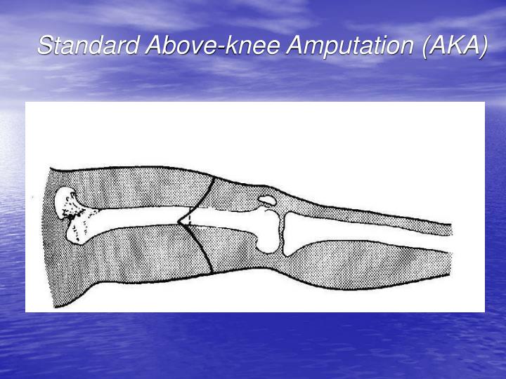 PPT - Indications to Amputations PowerPoint Presentation - ID:6719754