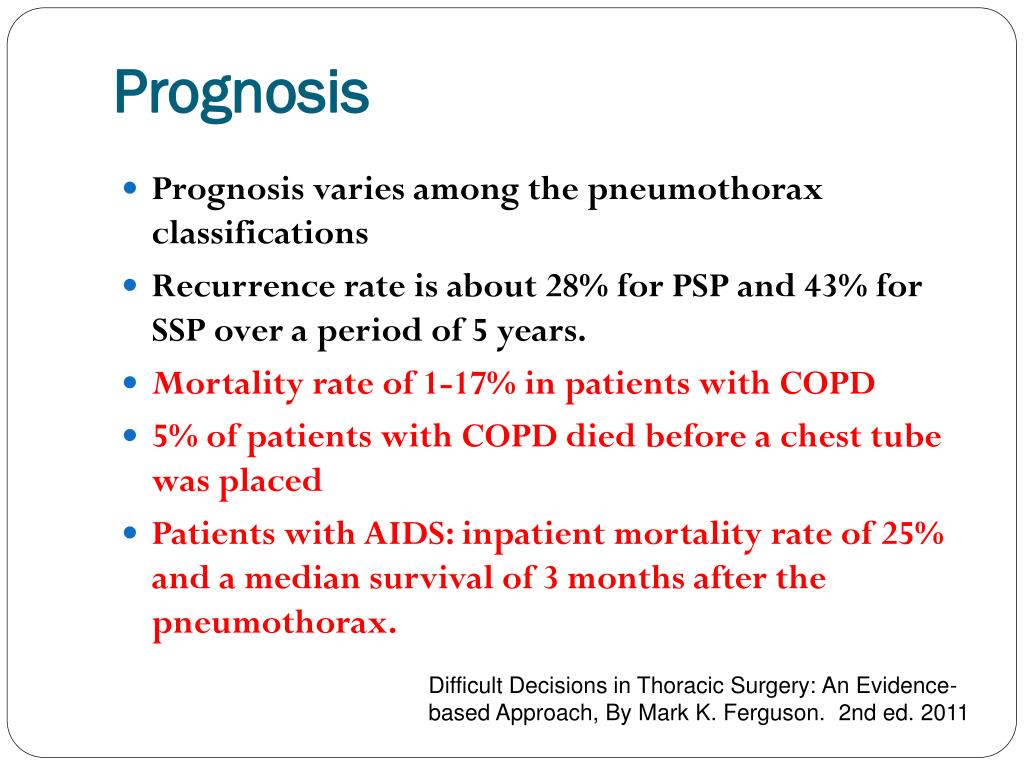 PPT - Diagnosis and Treatment of Pneumothorax PowerPoint Presentation ...