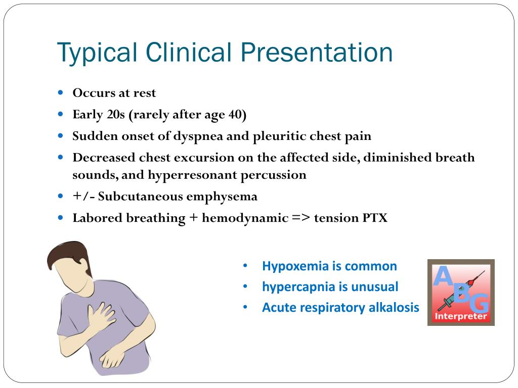 PPT - Diagnosis and Treatment of Pneumothorax PowerPoint Presentation ...