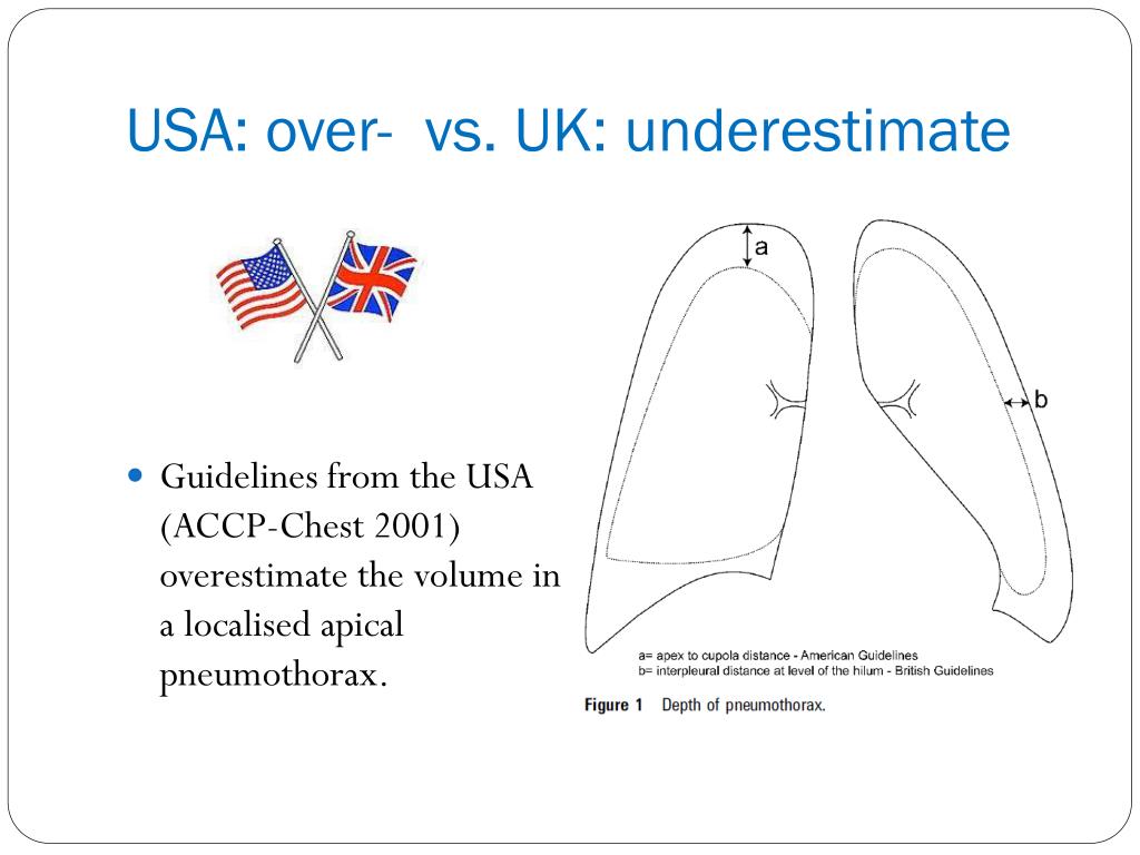 PPT - Diagnosis and Treatment of Pneumothorax PowerPoint Presentation ...