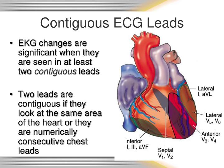 PPT - Rhythm & 12 Lead EKG Review PowerPoint Presentation - ID:6720077