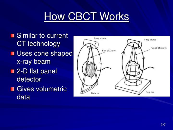 PPT - Dental Cone Beam CT PowerPoint Presentation - ID:6720679