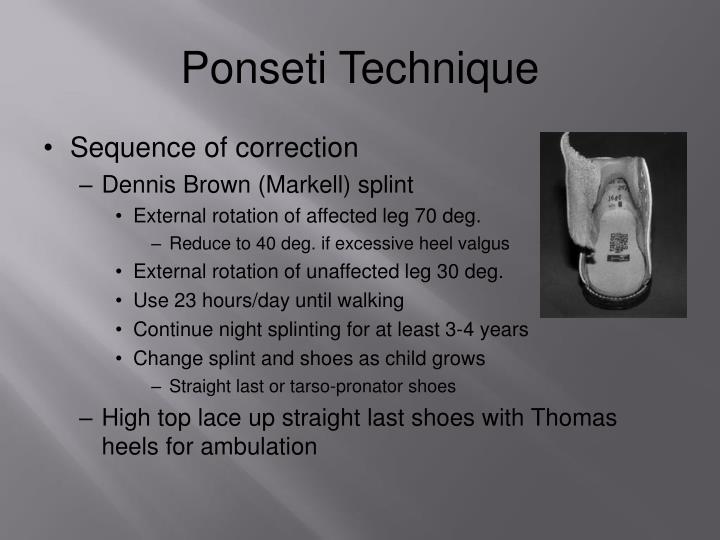 PPT - Ponseti Casting and Technique for Pediatric Clubfoot Management ...