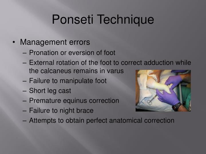 PPT - Ponseti Casting and Technique for Pediatric Clubfoot Management ...
