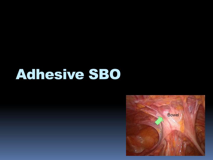 PPT - ADHESIVE small bowel obstruction PowerPoint Presentation - ID:6722760