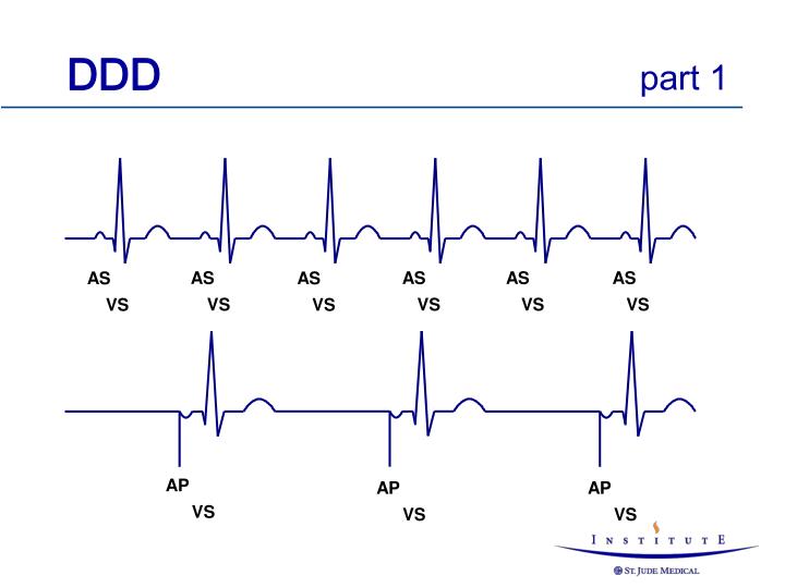 PPT - NBG Pacemaker Code PowerPoint Presentation - ID:6724840