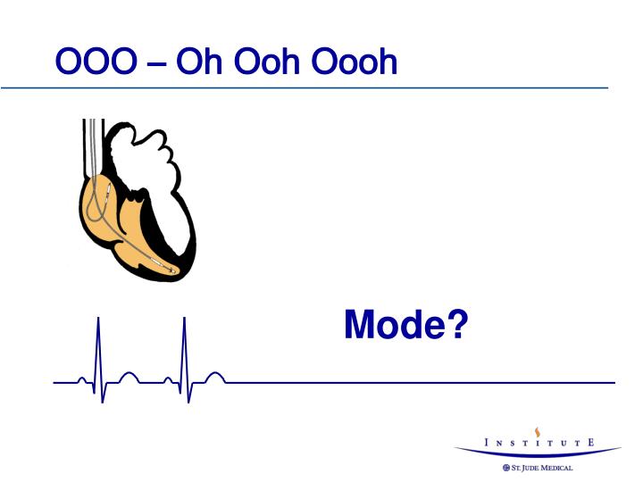 PPT - NBG Pacemaker Code PowerPoint Presentation - ID:6724840