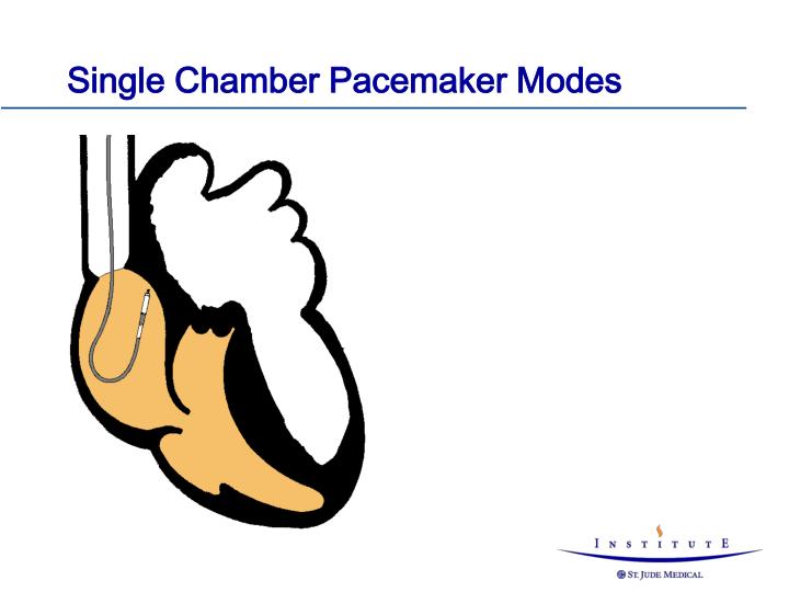 PPT - NBG Pacemaker Code PowerPoint Presentation - ID:6724840