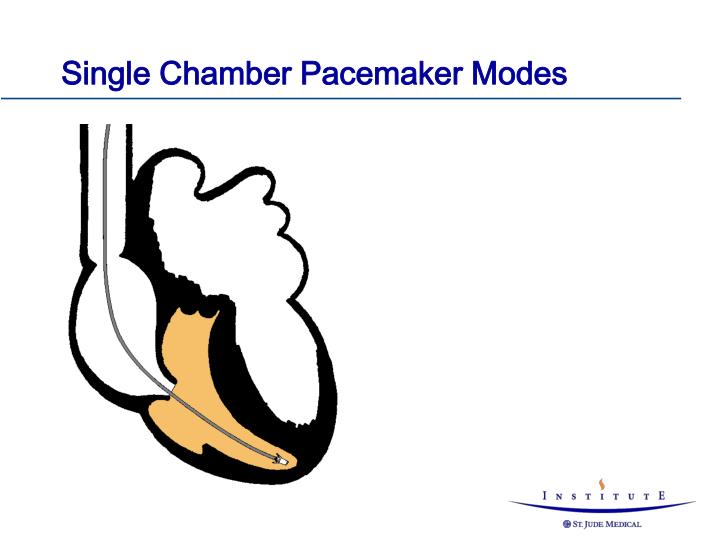 PPT - NBG Pacemaker Code PowerPoint Presentation - ID:6724840