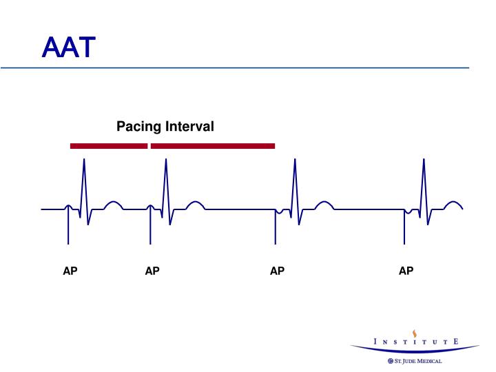 PPT - NBG Pacemaker Code PowerPoint Presentation - ID:6724840